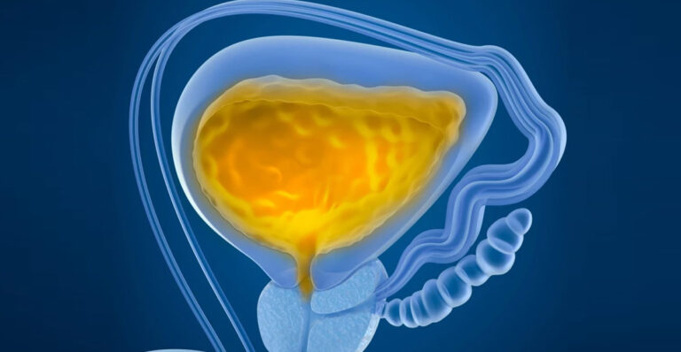 Neuropathic or Neurogenic Bladder - Dr. Heidi Stephany